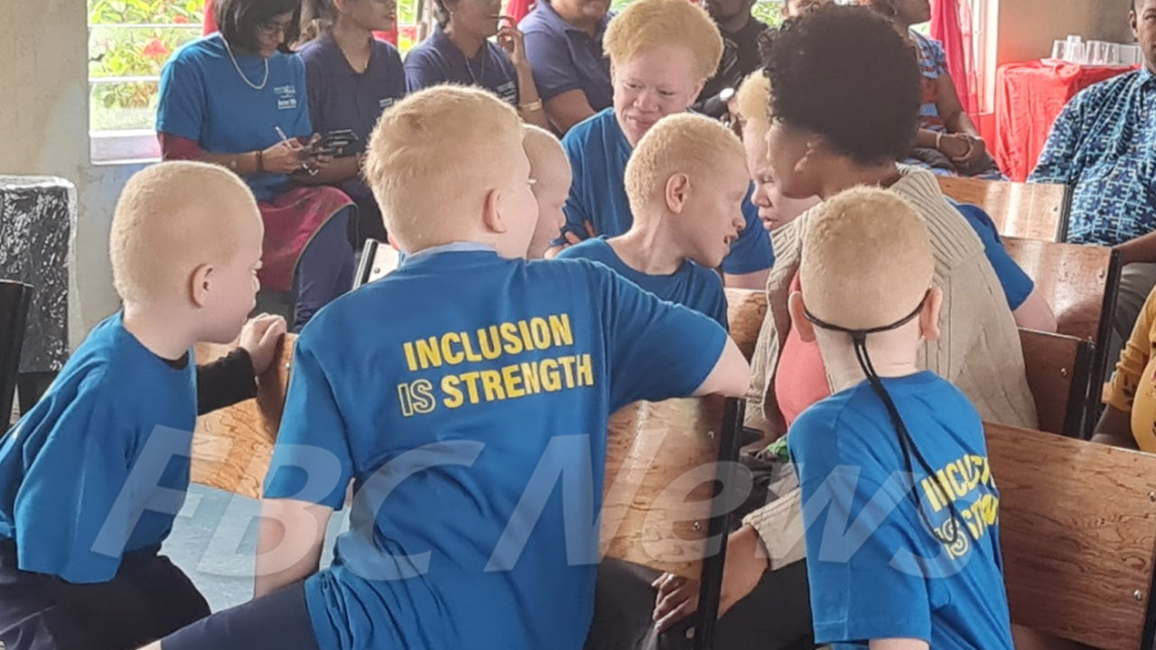 Call for registration of albinism: Dr Fong – FBC News