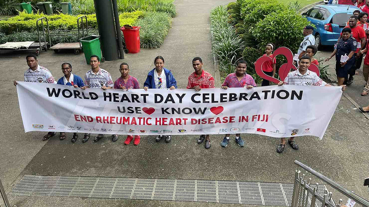 RHD back in the limelight – FBC News